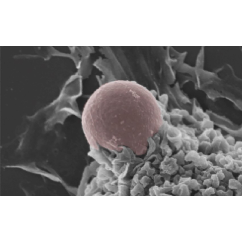 Comment le virus du rhume facilite les surinfections bactériennes | INSB