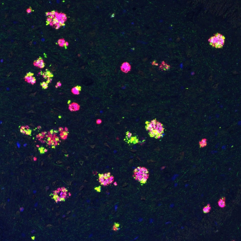 Maladie d’Alzheimer: perturbations synaptiques autour des plaques ...