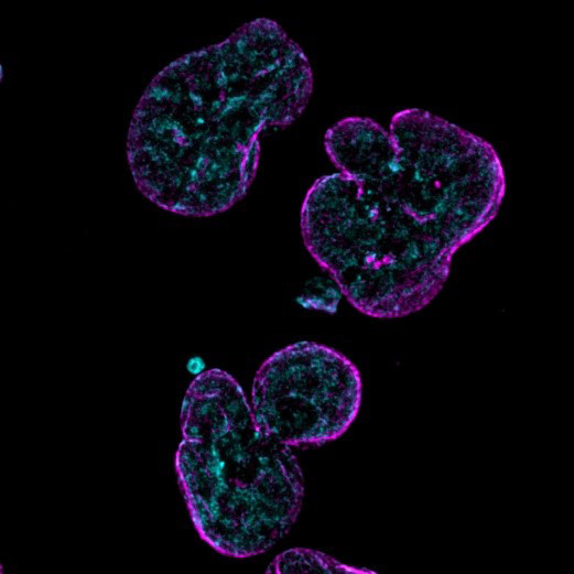 Quand le nombre de chromosomes déraille : un mécanisme inédit pour ...