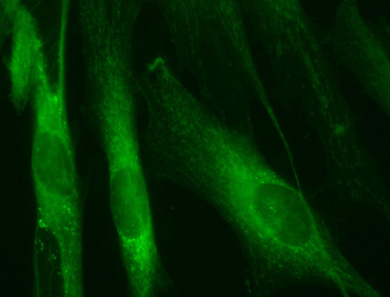 Good ROS Bad ROS : quand les espèces réactives de l'oxygène protègent l ...