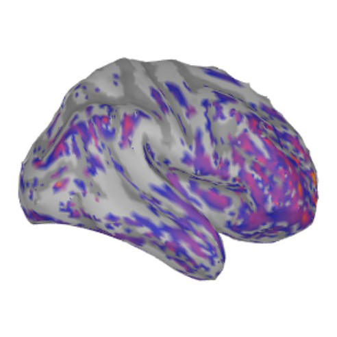 Des circuits neuronaux différents pour la perception et la confiance ...