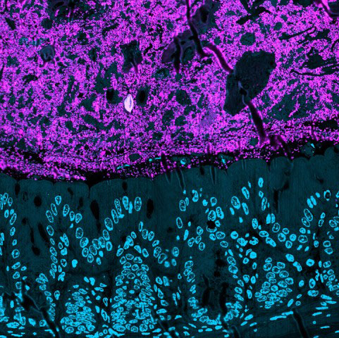 Microbiote : optimiser sa composition pour une meilleure protection ...