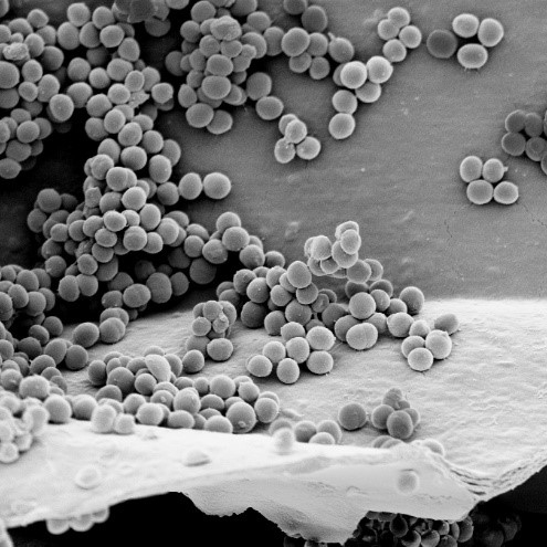 Staphylocoque doré : découverte d'une nouvelle enzyme impactant sa ...
